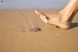 Mittelmeer: Wo Urlauber im Sommer 2025 auf Quallen & Seeigel achten ...